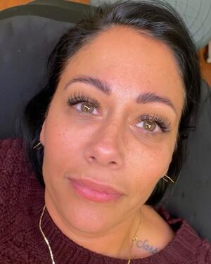 Gallery - Alyssa Aesthetics